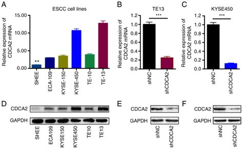 The Expression Of Cdca2 Is Upregulated In Escc Cell Lines A Cdca2