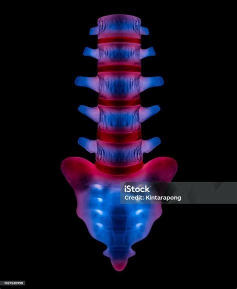요 추 척추천 골과 꼬리 뼈 빨간 강조 인간의 등뼈척추 디스크와 Sacroiliac 합동 X 선 통증 영역 앞쪽 보기3d 의료