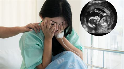 Médicos Practican Aborto Por Error A Mujer Embarazada Que Sólo Iba A
