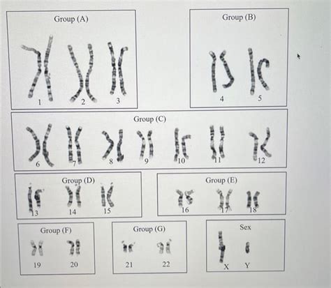 Solved On The Next Page Is A Banded Chromosome Spread From A Chegg