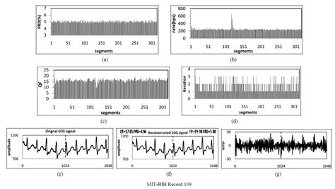 Wavelet Based Ecg Data Compression Optimization With Genetic Algorithm