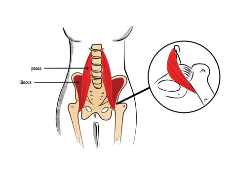 Psoas Pain Referral Pattern