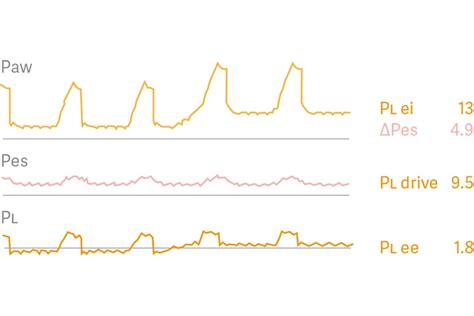 Getinge Servo U The Simple To Use Safer To Learn Mechanical Ventilator