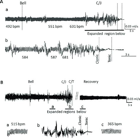 Respiratory Arrest Occurs During The Clonic Phase But Before The Start