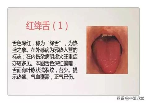 高清中医舌诊案例图不可多得强烈建议收藏 舌苔