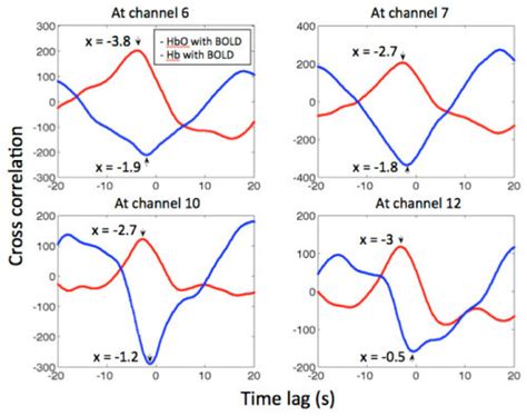 Cross Correlation Of Fnirs And Fmri Signals For A Representative Download Scientific Diagram