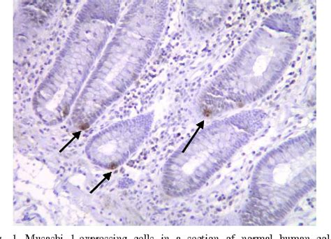 Figure 1 From Characterization Of Putative Stem Cells In Isolated Human Colonic Crypt Epithelial
