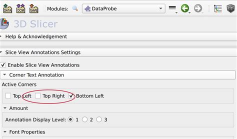 thick slab reconstruction corner annotation not visible by default in slice viewer · issue 7092