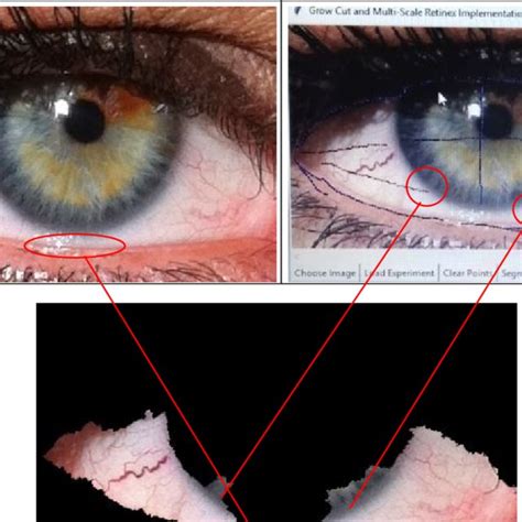 Sample 1 Image Analysis Based On Initial Selection Of Labels Download