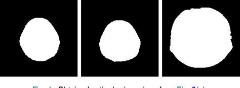 Figure 4 From Novel Robust Automatic Brain Tumor Detection And