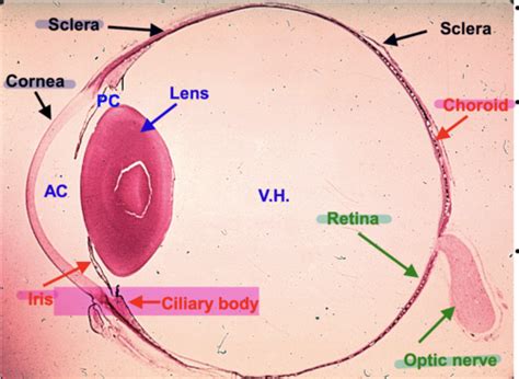 Systemic Path Ocular Path Flashcards Quizlet