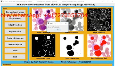 Blood Cancer Detection Using Image Processing Full Matlab Source Code IEEE Based Projects