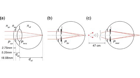 Wavefront Propagation Based Methods Fresnel Fraunhofer Regimesare The Ultimate Approaches
