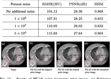 Figure 13 From Prior Image Constrained Iterative Reconstruction With Adaptive Step Size For