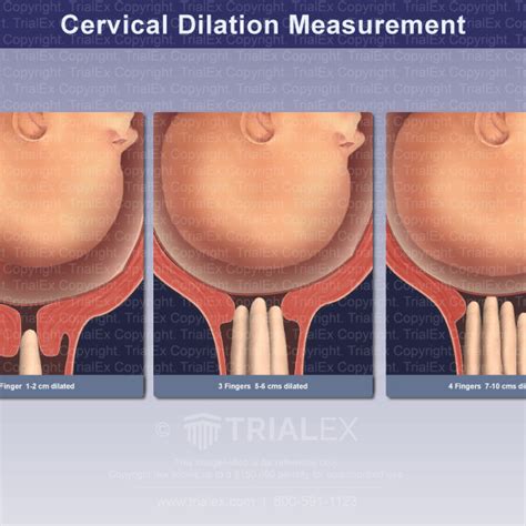 Cervix Dilation Chart Signs Stages And Procedure To Check 44 Off
