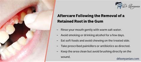 Piece Of Tooth Left After Extraction 8 Symptoms And Dangers
