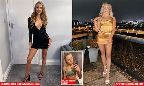 I Battled Eating Disorders In Secret For Years Nhs Wait Times Are So Long Daily Mail Online