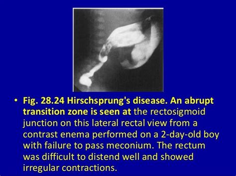 28 David Sutton Pictures The Pediatric Abdomen