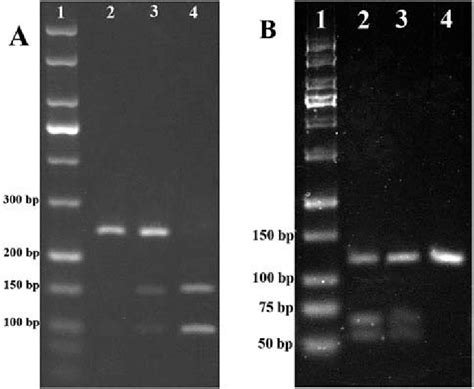 RFLP Analysis Of XRCC And LIG Polymorphisms Were Investigated By Download Scientific Diagram