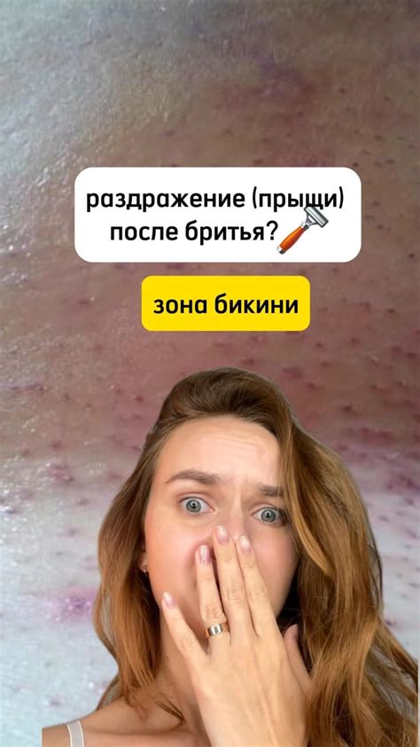Прыщи после бритья🪒 Зона бикини Советы для бритья Советы для