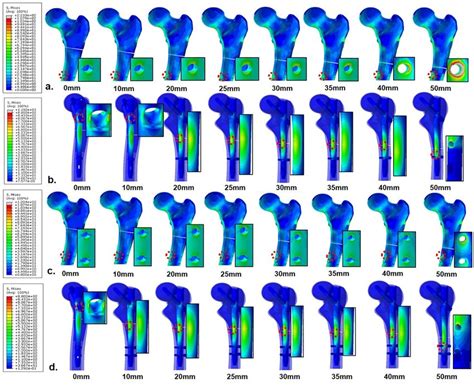 Stress Distribution Around The Cortical Bone And Implant Of Finite Download Scientific Diagram