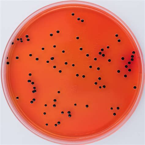 Crm For Iso 6579 1 And Iso 6579 2 • Biosistostandard