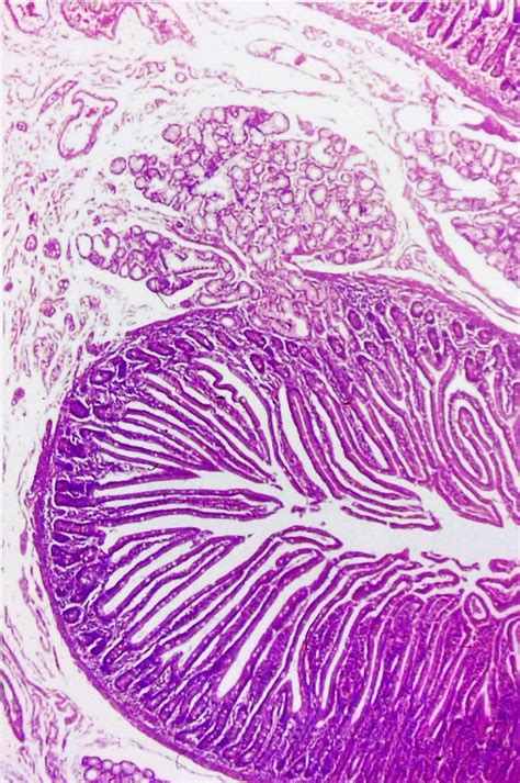 Schaubild „duodenum“ Quizlet