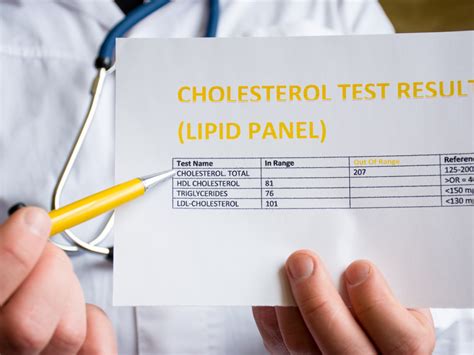 Cholesterol Good Bad Normal Know What These Monikers Exactly Mean Is It Too Easy To