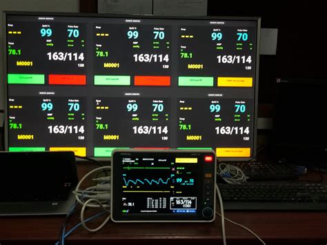 How Would You Build A Medical Device Iot Live Dahsboard In Phoenix