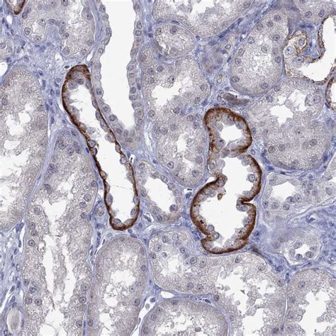 Rabbit Polyclonal Anti Nsmf Antibody Buy For Research Highly