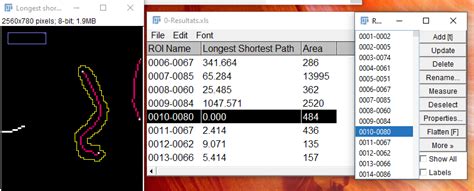 How To Combine Skeletonize And Analyze Particles Image Analysis Imagesc Forum