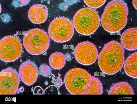 False Colour Transmission Electron Micrograph Tem Of The Gram Positive Bacteria Streptococcus