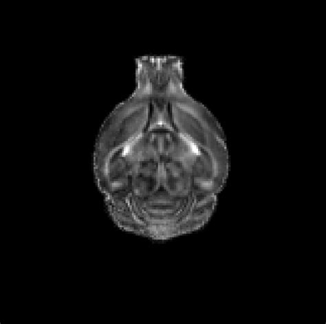 Mouse Brain 6 Direction Epi Dti Biomedical Research Imaging Center