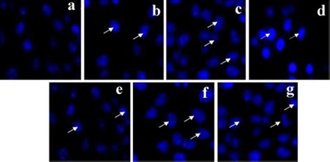Dapi Apoptotic Analysis Of Treated Cells A Control Cells B D Compound Download Scientific