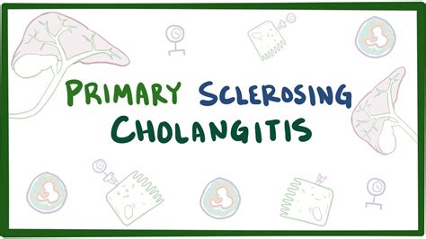 Primary Sclerosing Cholangitis Video And Anatomy Osmosis