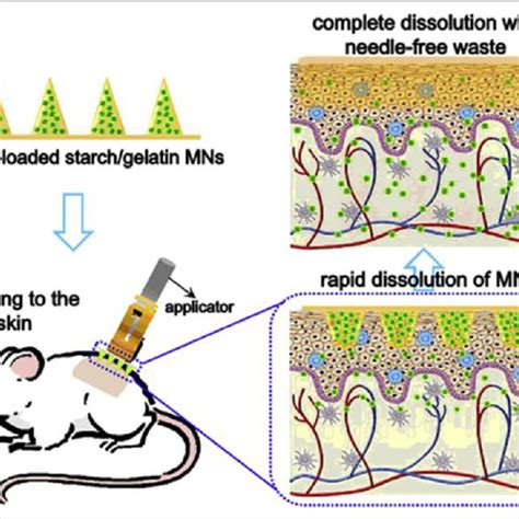 Pdf Microneedle System For Transdermal Drug And Vaccine Delivery Devices Safety And Prospects