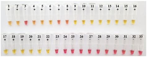 The Development Of Novel Reverse Transcription Loop Mediated Isothermal Amplification Assays For