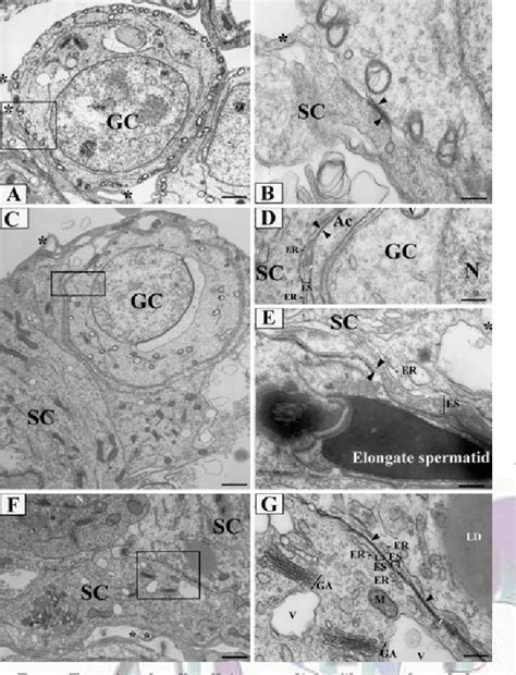 Figure 1 From Sertoli Germ Cell Anchoring Junction Dynamics In The Testis Are Regulated By An