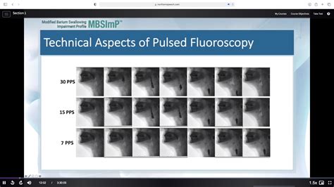Mbsimp 10 Year Renewal Course Dysphagia Online Training