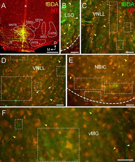 Anterograde Tracing From The Mntb Figure A Shows An Injection Site Of