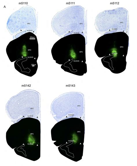 Figure S3 Delineation Of Injection Sites In Orbitofrontal Cortex A Download Scientific