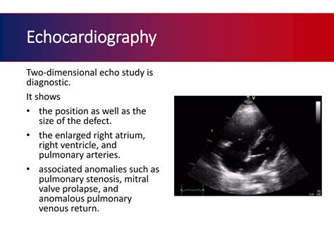 Atrial Septal Defect PPTX