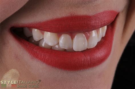 Brb Matrix A Simple Way To Produce Lingual Matrix