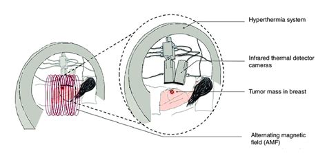 A Noninvasive Thermometry Method Using An Infrared Thermal Detector