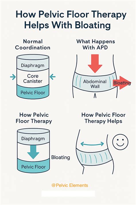 How Pelvic Floor Therapy Helps With Bloating