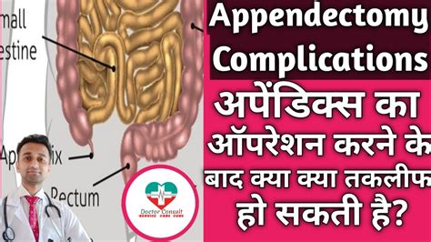 Appendectomy Complications। अपेंडिक्स का ऑपरेशन करने के बाद क्या क्या