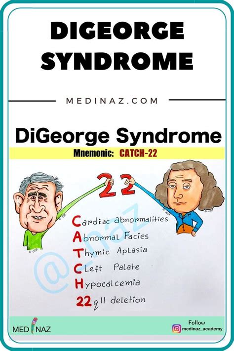 Digeorge Syndrome Artofit