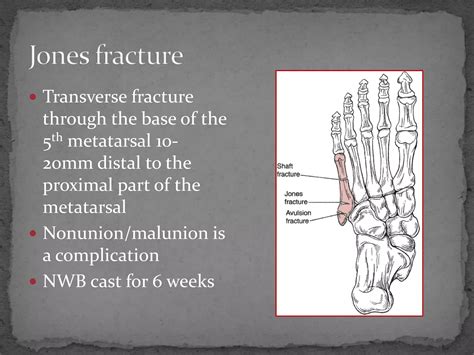 Fracture Review New Format Pptx