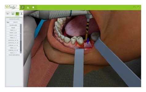 Haptic Simulator And Virtual Exercises A Overview Of The Simulator