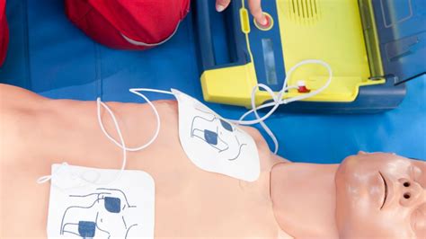 Advice For Using Automated External Defibrillator To Restart A Heart